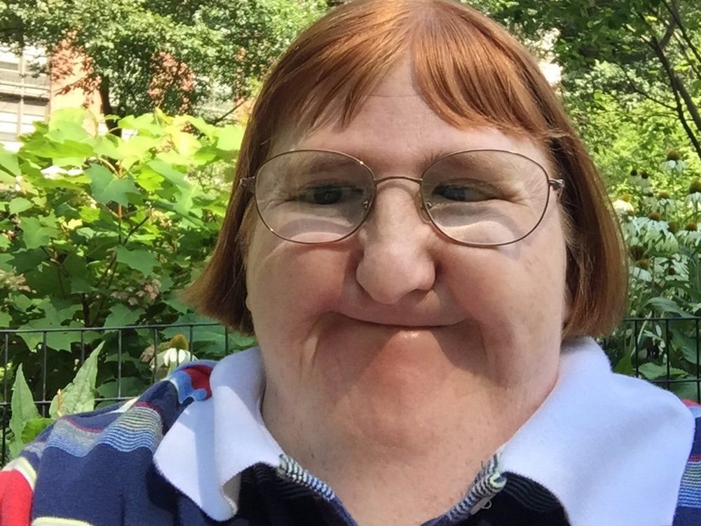 La historia de Melissa Blake: de "deberían prohibir fotografiarte" a ...